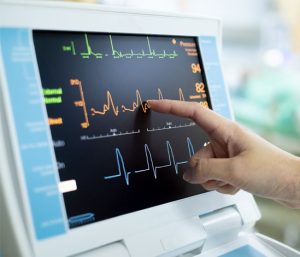 Electrophysiology | Cardiac Tests for Heart Arrhythmias | EP Studies