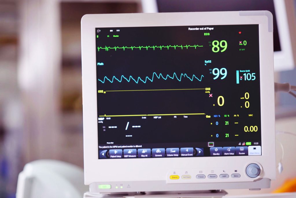 Arrhythmia Monitoring | Diagnostic Testing for Heart Arrhythmias
