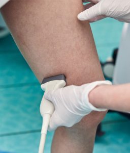 Peripheral Artery Intervention Procedure | Removing Plaque from Arteries